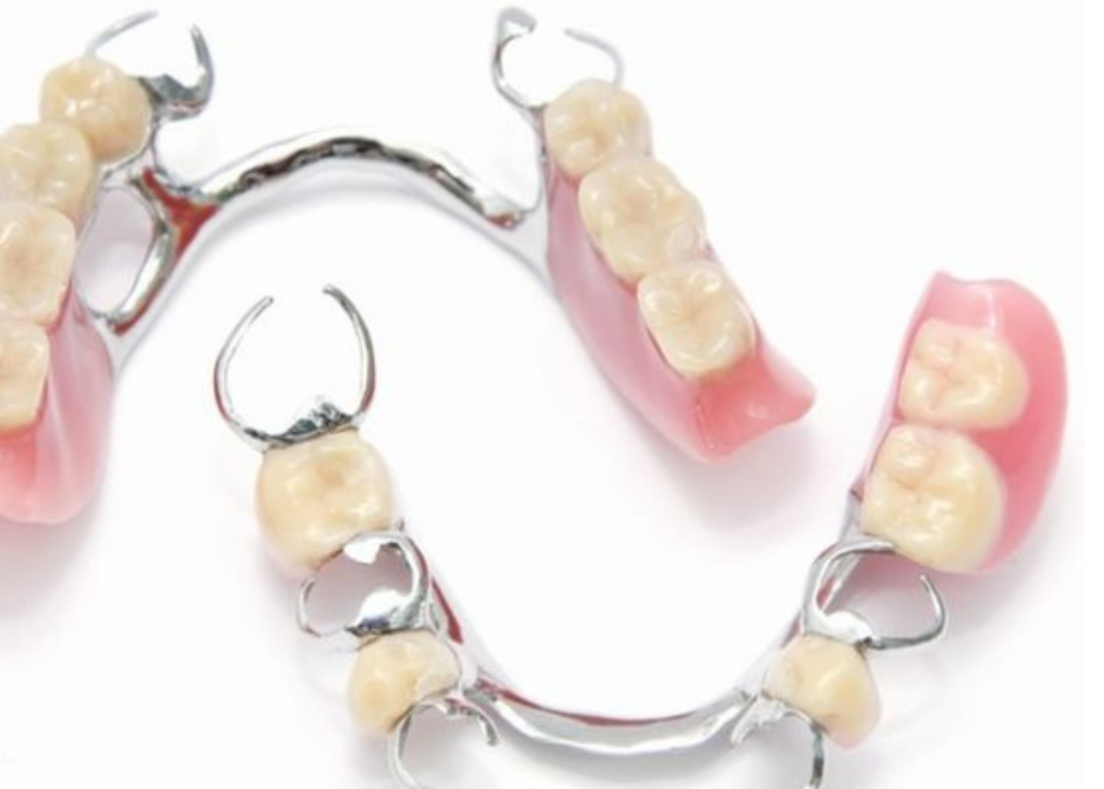 Prótese dentária removível: tipos, modelos e indicações – Paraíso Odonto