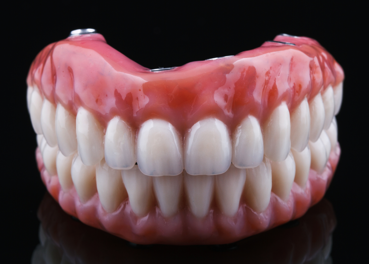 Prótese dentária removível: tipos, modelos e indicações – Paraíso Odonto